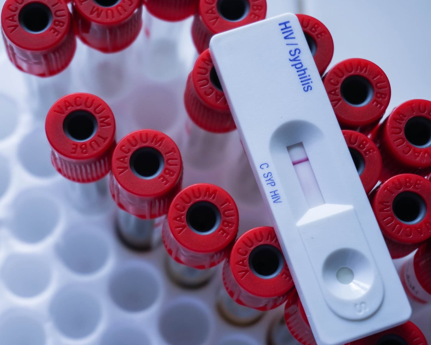 Hep C & HIV Testing | ADIO Trust